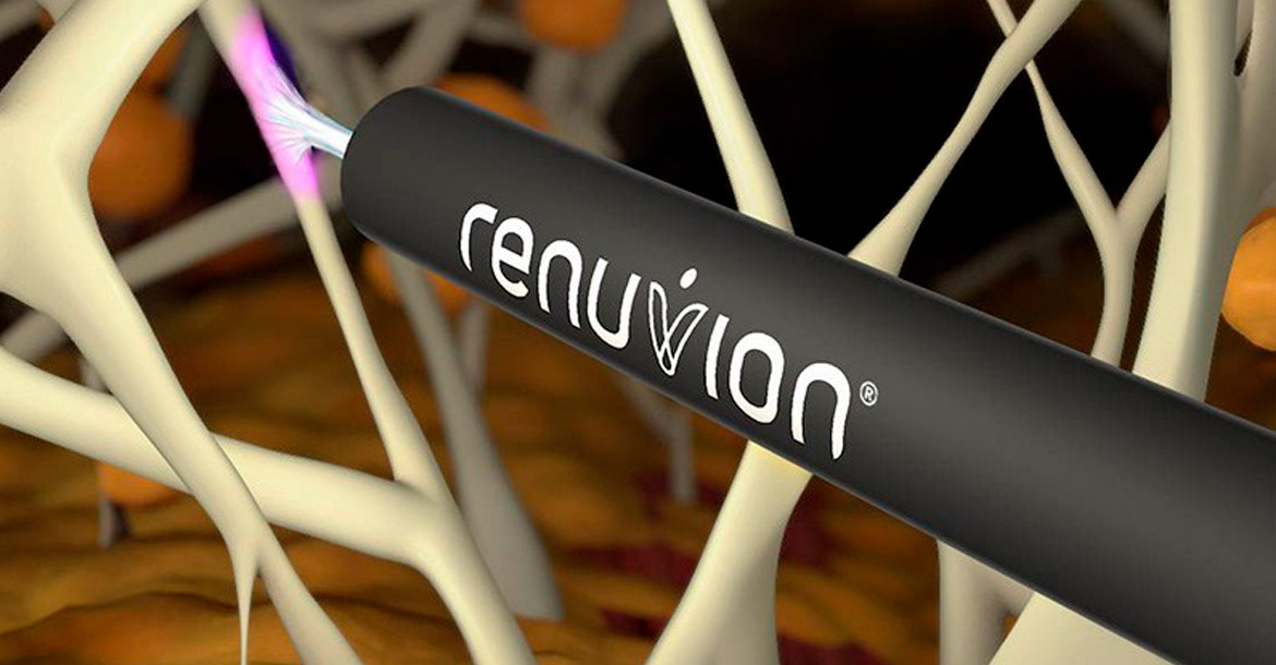 Renuvion - Equipamento para tratamento de flacidez de pele.